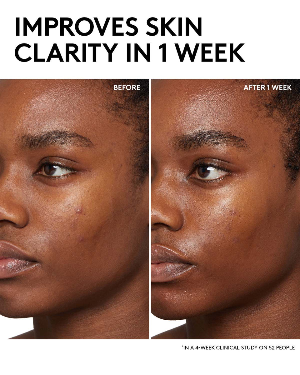 Fenty Skin Start’rs Full-Size Bundle: Oily Skin Edition | Fenty Skin